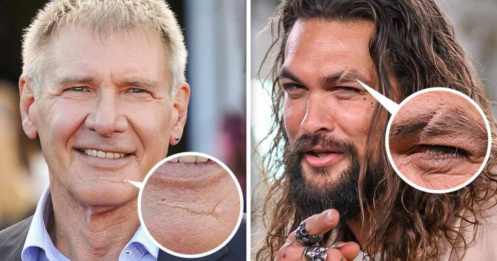 Men With Facial Scars Are More Attractive to Women, According to a ...